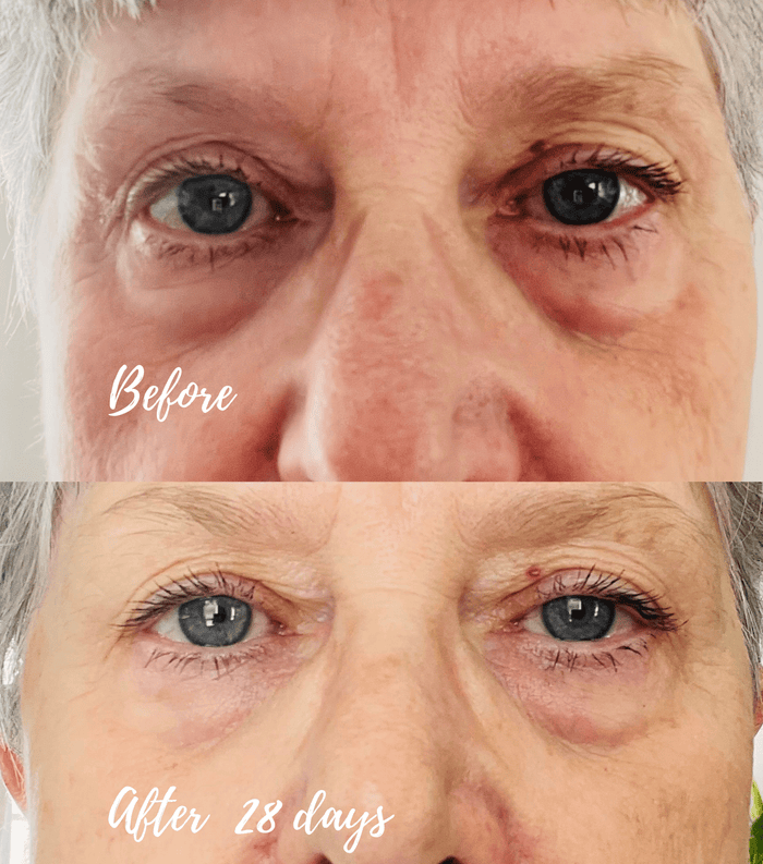 Collagen Plump Eye Cream | BOOST LAB