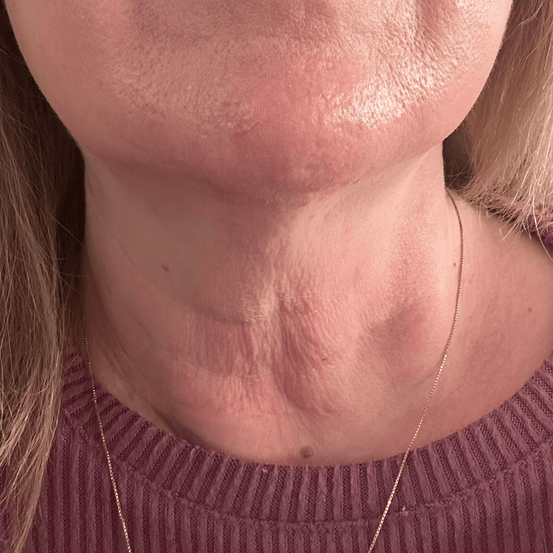 Neck Firming Serum | BOOST LAB