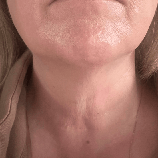 Neck Firming Serum | BOOST LAB